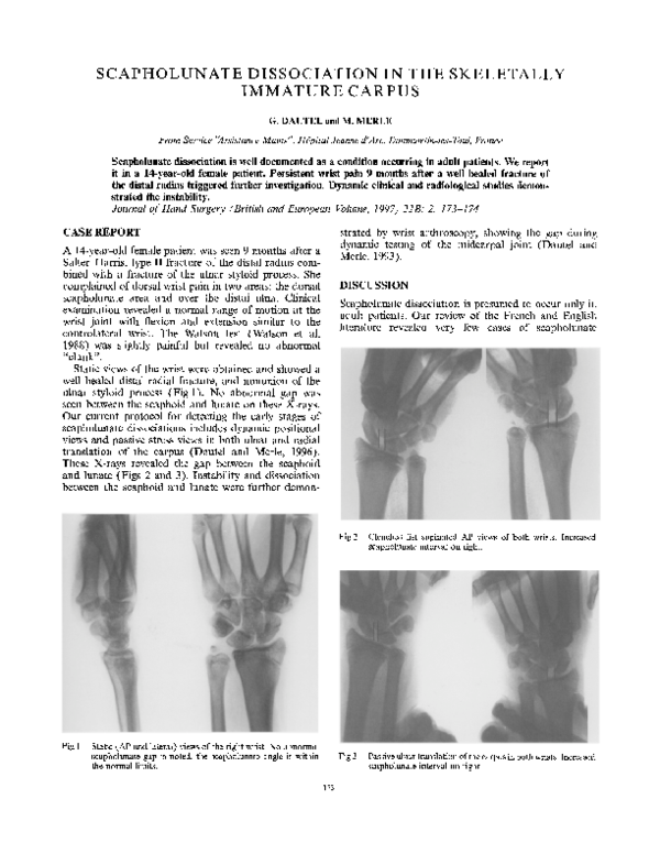 (PDF) Scapholunate dissociation in the skeletally immature carpus | G ...