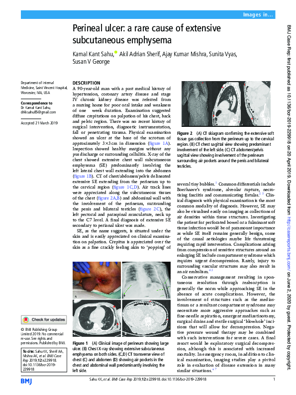 (PDF) Perineal ulcer: a rare cause of extensive subcutaneous emphysema ...