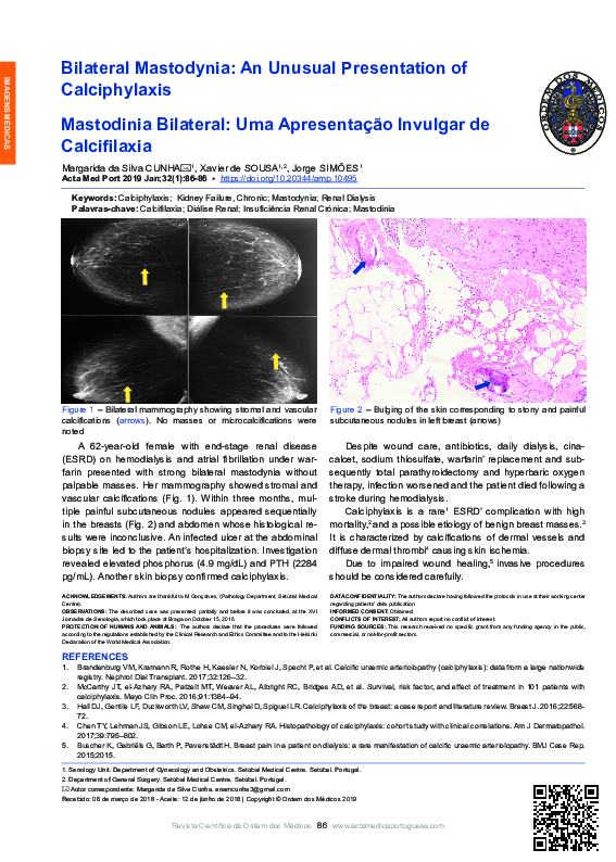 (PDF) Bilateral Mastodynia: An Unusual Presentation of Calciphylaxis ...