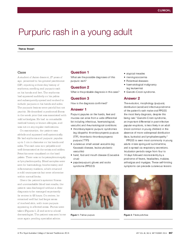 (PDF) Purpuric rash in a young adult