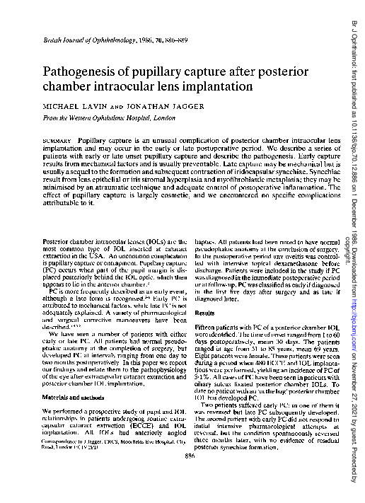 (PDF) Pathogenesis of pupillary capture after posterior chamber ...