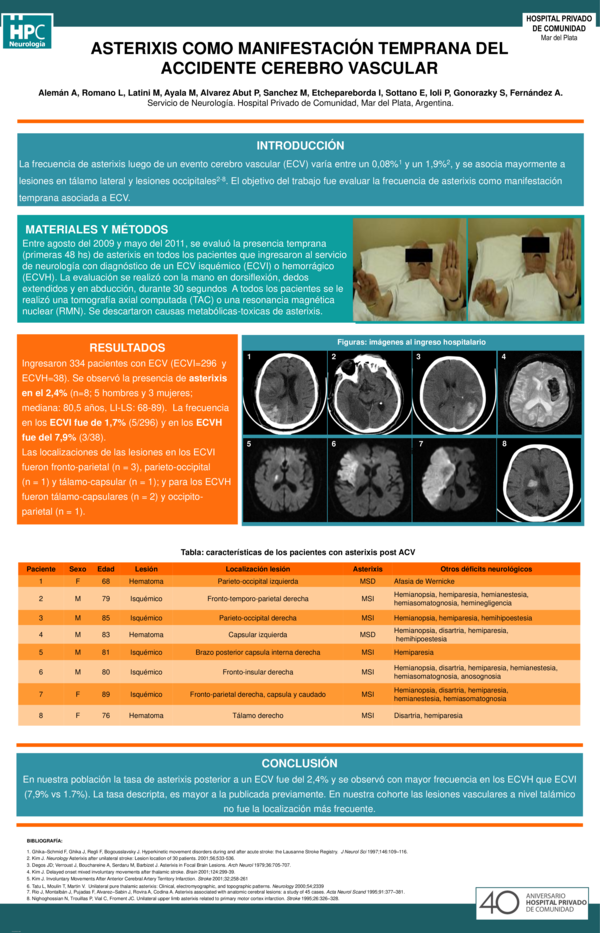 (PDF) Asterixis Como Manifestación Temprana Del Accidente Cerebro ...