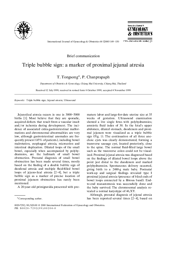 (PDF) Triple bubble sign: a marker of proximal jejunal atresia