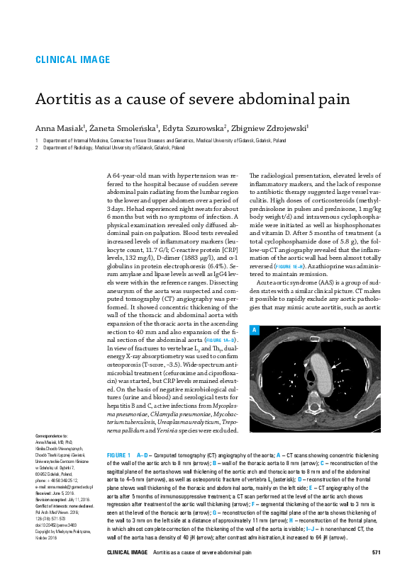 (PDF) Aortitis as a cause of severe abdominal pain
