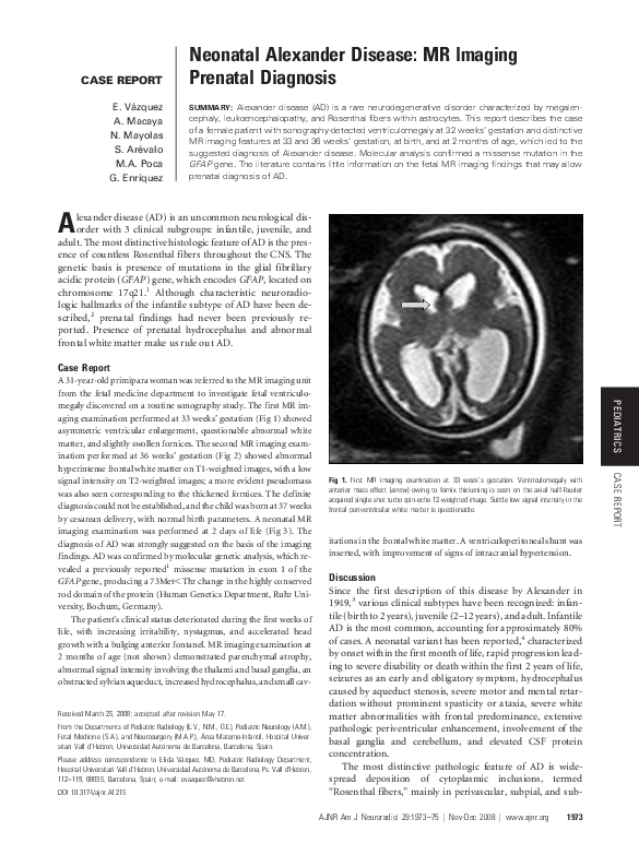 (PDF) Neonatal Alexander Disease: MR Imaging Prenatal Diagnosis