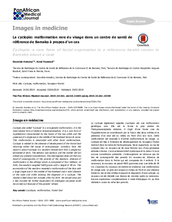 (PDF) La cyclopie: malformation rare du visage dans un centre de santé ...