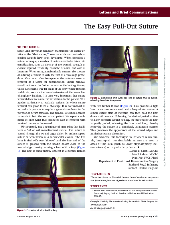 (PDF) The Easy Pull-Out Suture