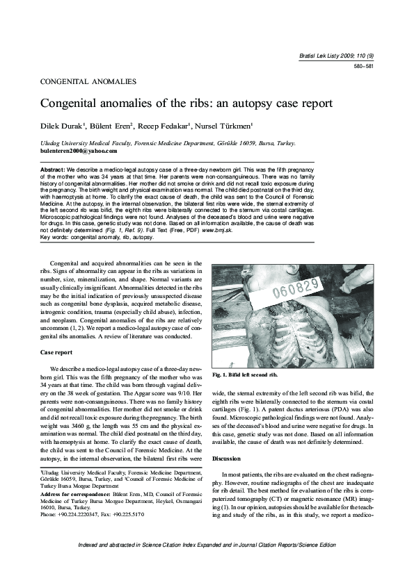 (PDF) Congenital anomalies of the ribs: An autopsy case report | Nursel ...