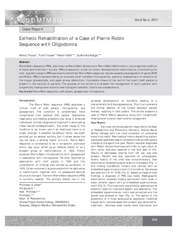(PDF) “Esthetic Rehabilitation of a Case of Pierre Robin Sequence with ...