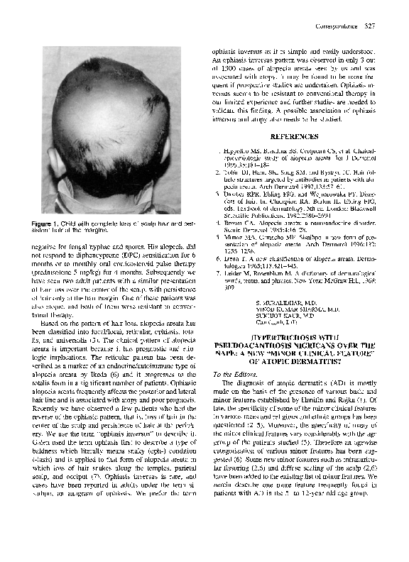 (PDF) Hypertrichosis with Pseudoacanthosis Nigricans Over the Nape: A ...