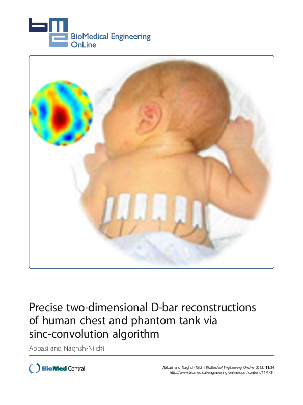 (PDF) Precise two-dimensional D-bar reconstructions of human chest and ...