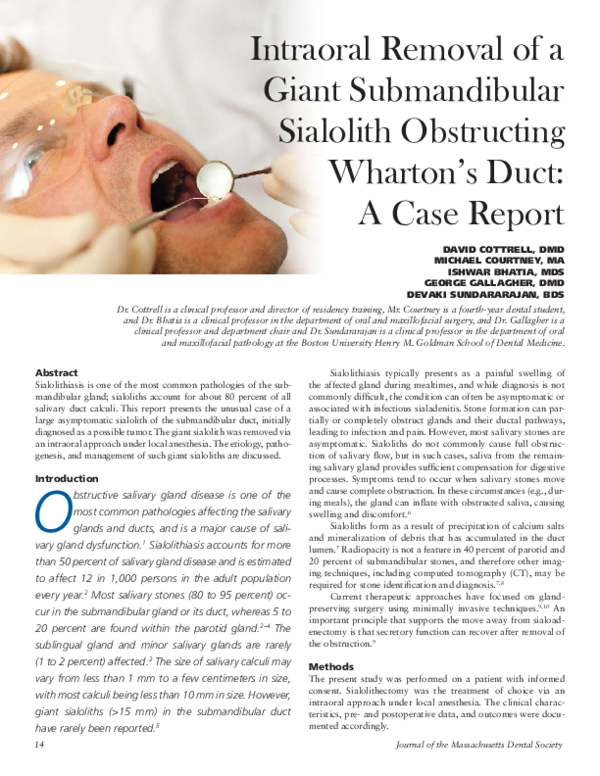 (PDF) Intraoral removal of a giant submandibular sialolith obstructing ...