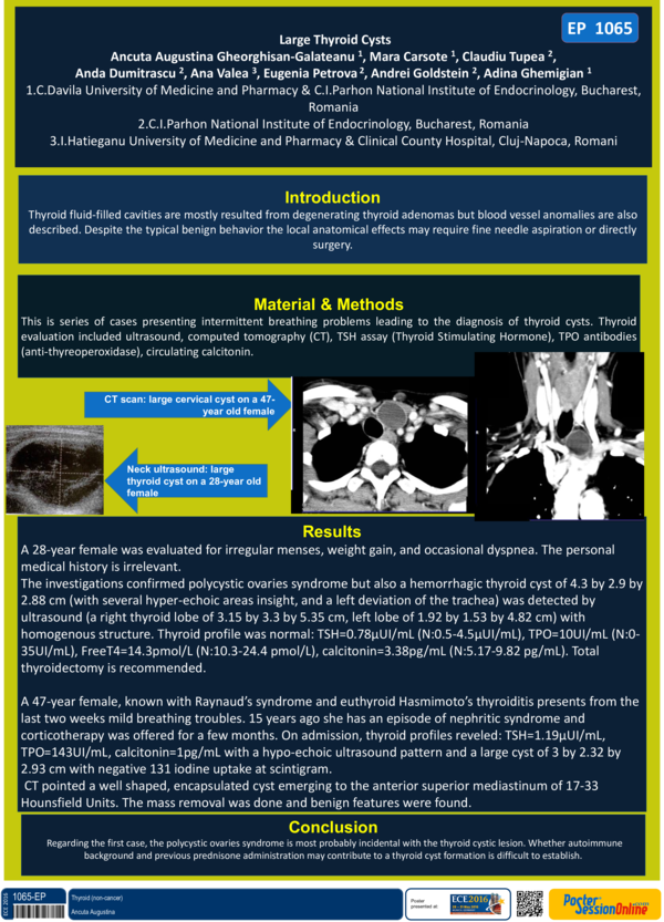 (PDF) Large thyroid cysts