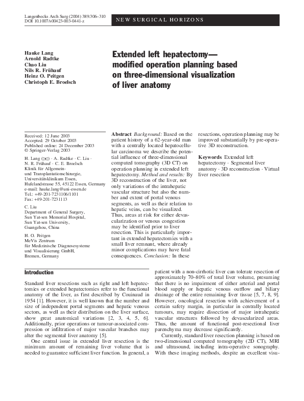 (PDF) Extended left hepatectomy?modified operation planning based on ...