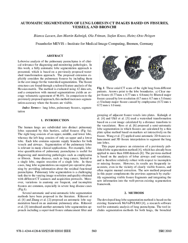 (PDF) Automatic segmentation of lung lobes in ct images based on fissures, vessels, and bronchi