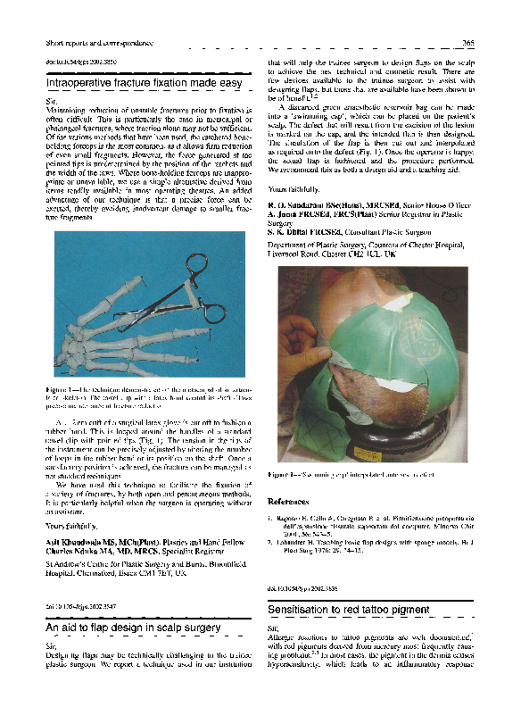 (PDF) An aid to flap design in scalp surgery