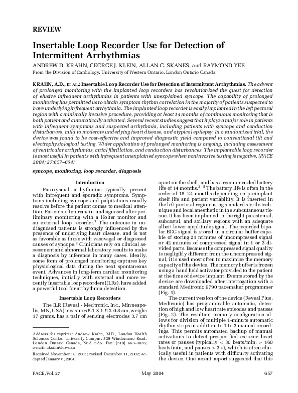 (PDF) Loop Recorder for Intermittent Arrhythmia Detection