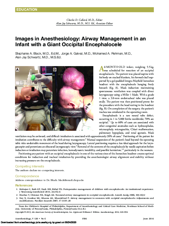 (PDF) Airway Management in an Infant with a Giant Occipital ...