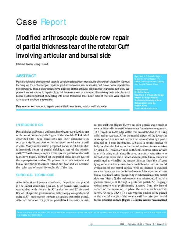 (PDF) Modified arthroscopic double row repair of partial thickness tear ...