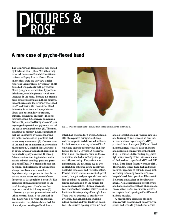 (PDF) A rare case of psycho-flexed hand