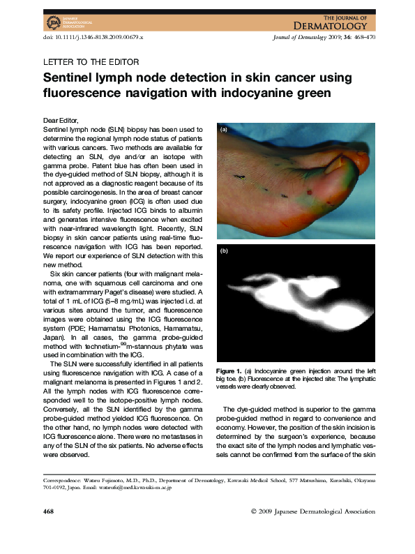 (PDF) Sentinel lymph node detection in skin cancer using fluorescence ...