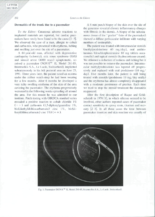 (PDF) Dermatitis of the trunk due to a pacemaker