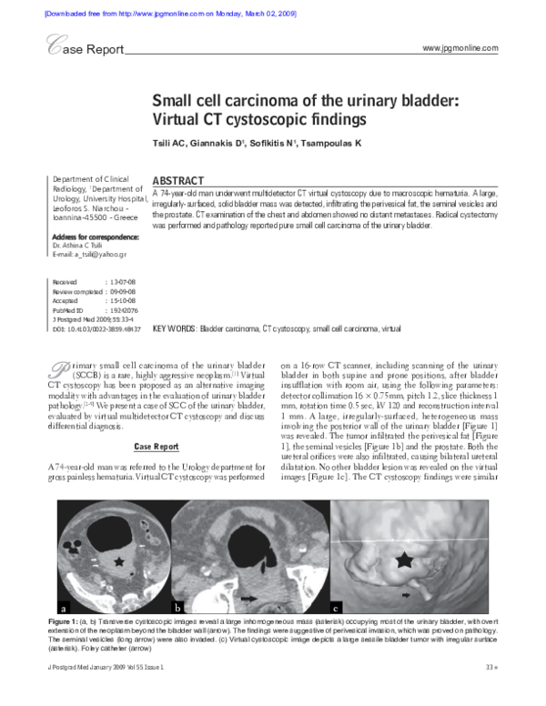 (PDF) Small cell carcinoma of the urinary bladder: Virtual CT ...