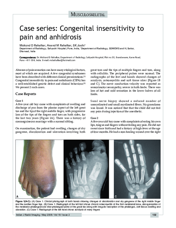 (PDF) Case series: Congenital insensitivity to pain and anhidrosis
