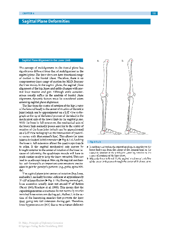 (PDF) Sagittal Plane Deformities