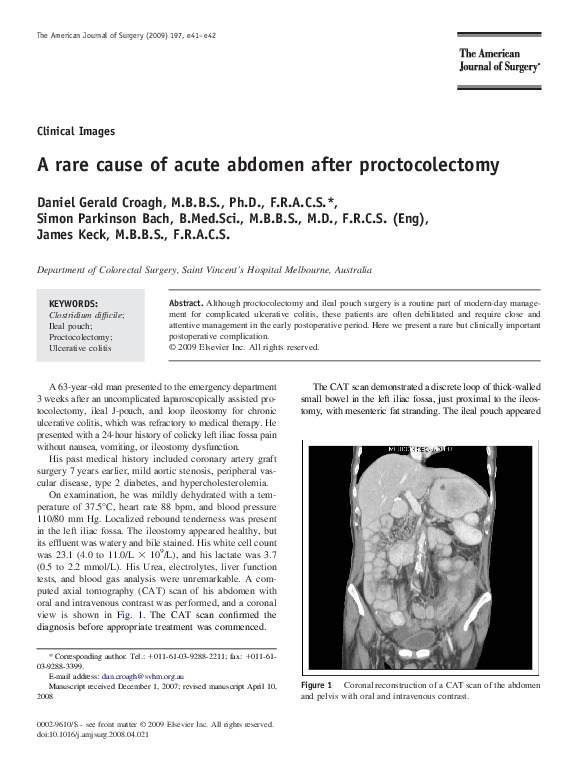 A rare cause of acute abdomen after proctocolectomy