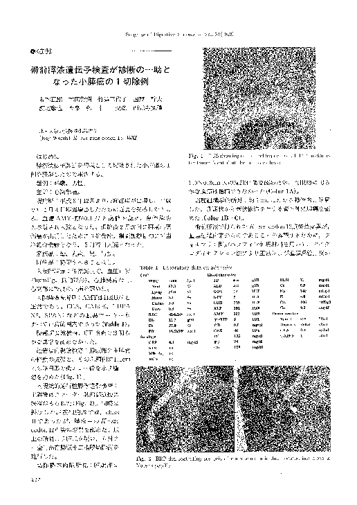 (PDF) 術前膵液遺伝子検査が診断の一助となった小膵癌の1切除例 | Mitsuhiro Kida - Academia.edu