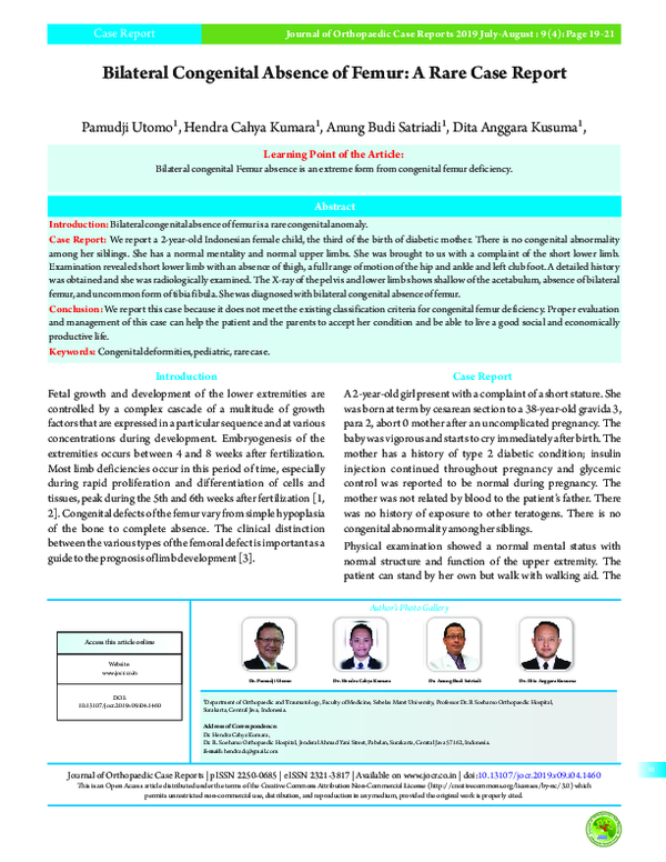 (PDF) Bilateral Congenital Absence of Femur: A Rare Case Report