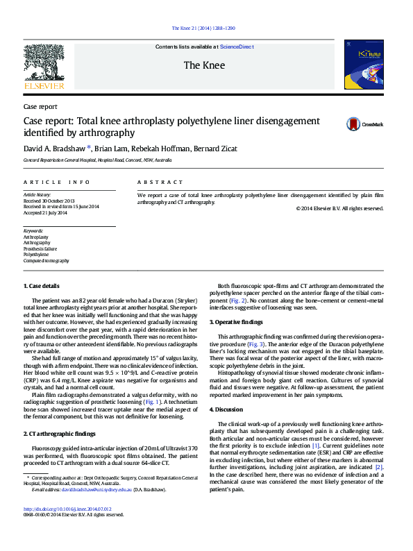 (PDF) Case report: Total knee arthroplasty polyethylene liner ...