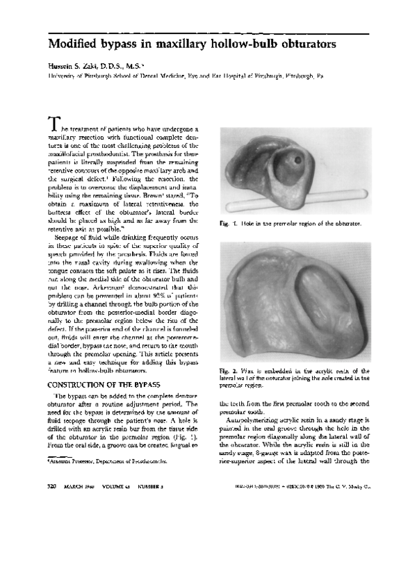 (PDF) Modified bypass in maxillary hollow-bulb obturators