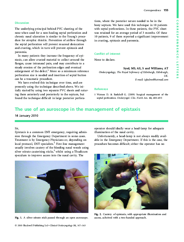 (PDF) The use of an auroscope in the management of epistaxis