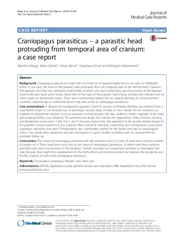 (PDF) Craniopagus parasiticus – a parasitic head protruding from ...