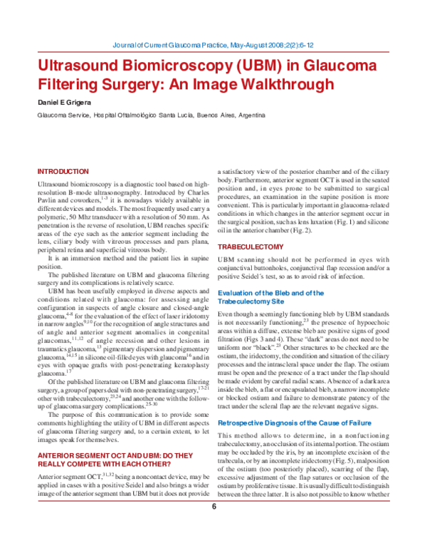 (PDF) Ultrasound Biomicroscopy (UBM) in Glaucoma Filtering Surgery: An ...