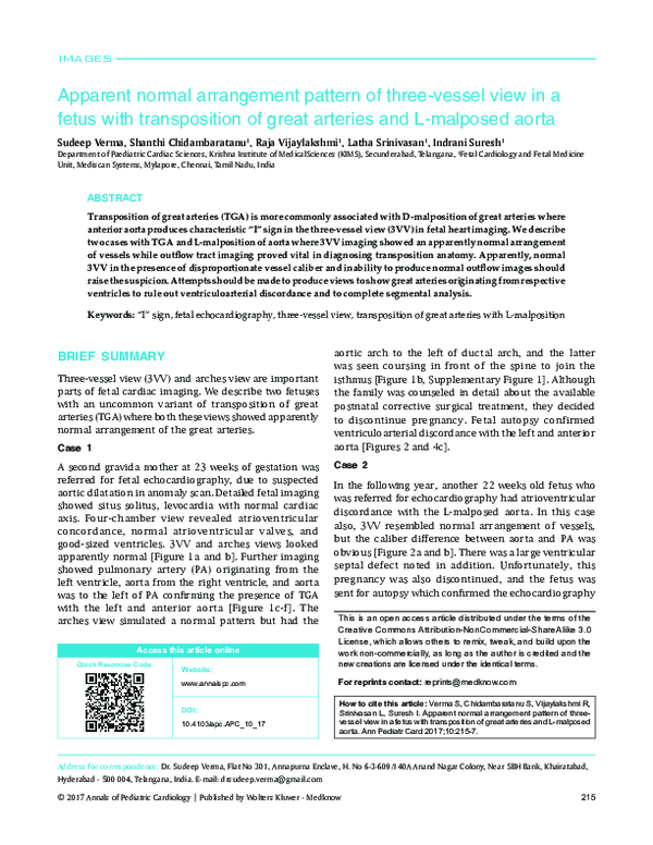 (PDF) Apparent normal arrangement pattern of three-vessel view in a ...
