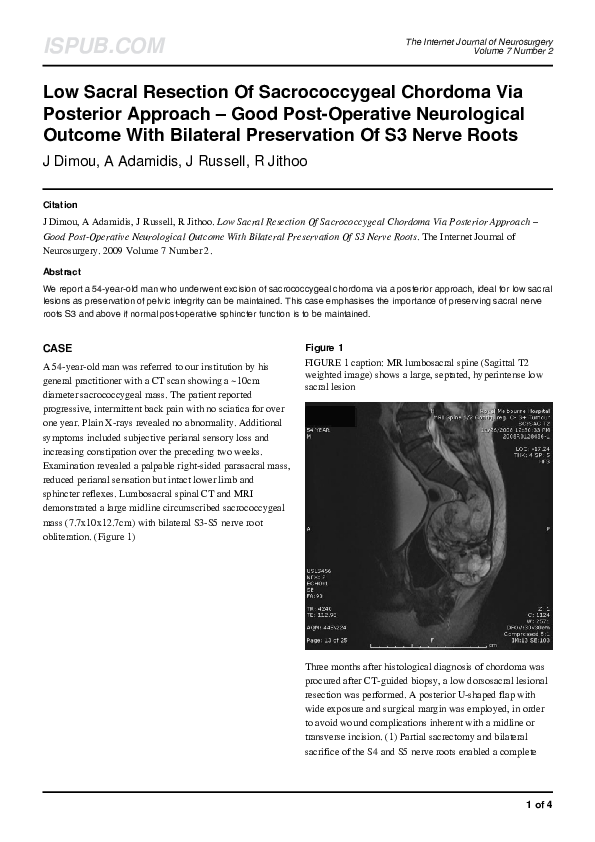 (PDF) Low Sacral Resection Of Sacrococcygeal Chordoma Via Posterior ...