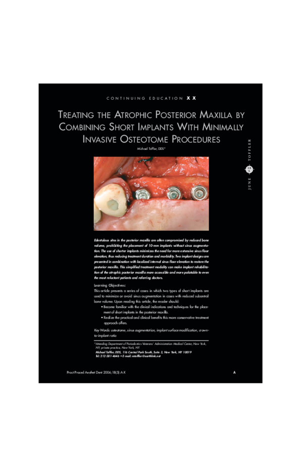 (PDF) Treating the atrophic posterior maxilla by combining short ...