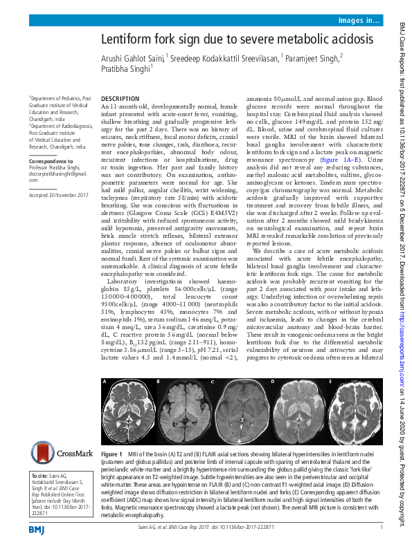 (PDF) Lentiform fork sign due to severe metabolic acidosis