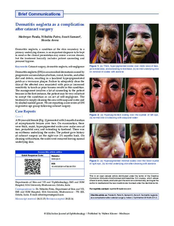 (PDF) Dermatitis neglecta as a complication after cataract surgery