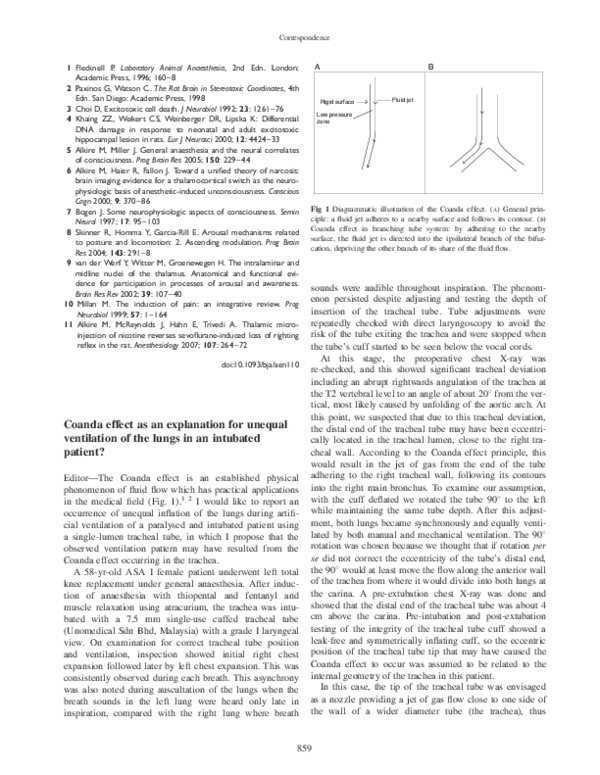 (PDF) Coanda effect as an explanation for unequal ventilation of the ...