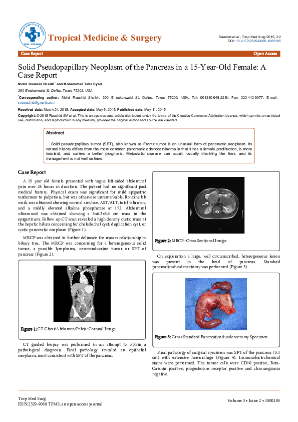 (PDF) Solid Pseudopapillary Neoplasm of the Pancreas in a 12-Year-Old Female: Case Report and ...
