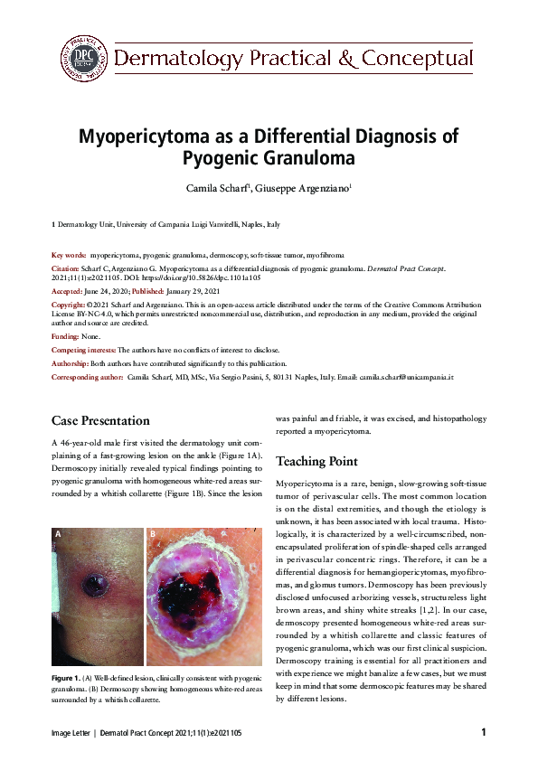 (PDF) Dermatology Practical & Conceptual Myopericytoma as a ...