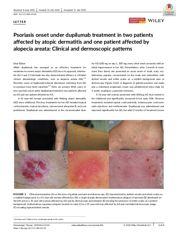 (PDF) Psoriasis onset under dupilumab treatment in two patients affected by atopic dermatitis ...