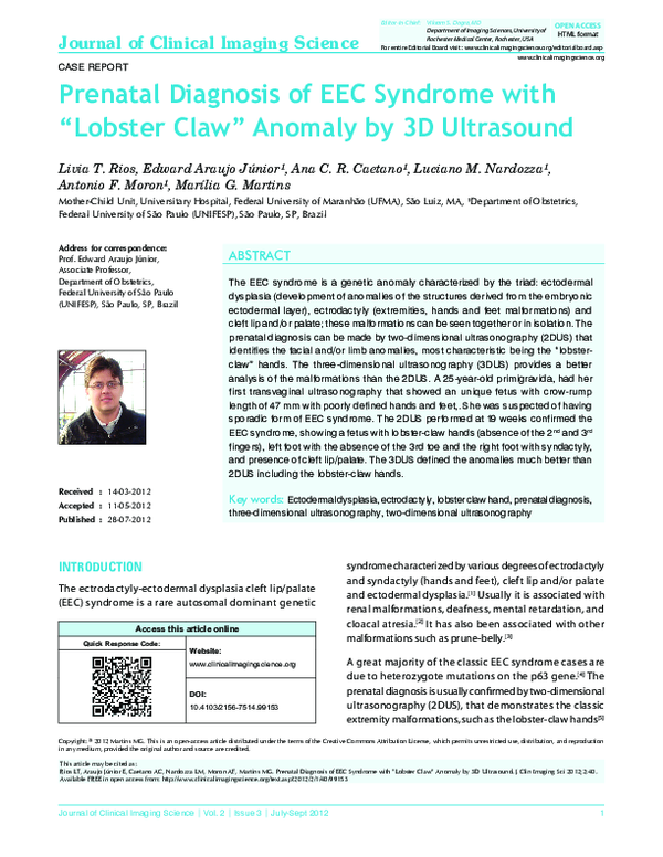 (PDF) Prenatal Diagnosis of EEC Syndrome with "Lobster Claw" Anomaly by ...