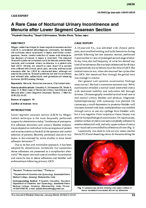 (PDF) A Rare Case of Nocturnal Urinary Incontinence and Menouria after ...