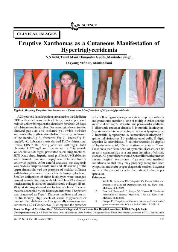 (PDF) Eruptive Xanthomas as a Cutaneous Manifestation of ...