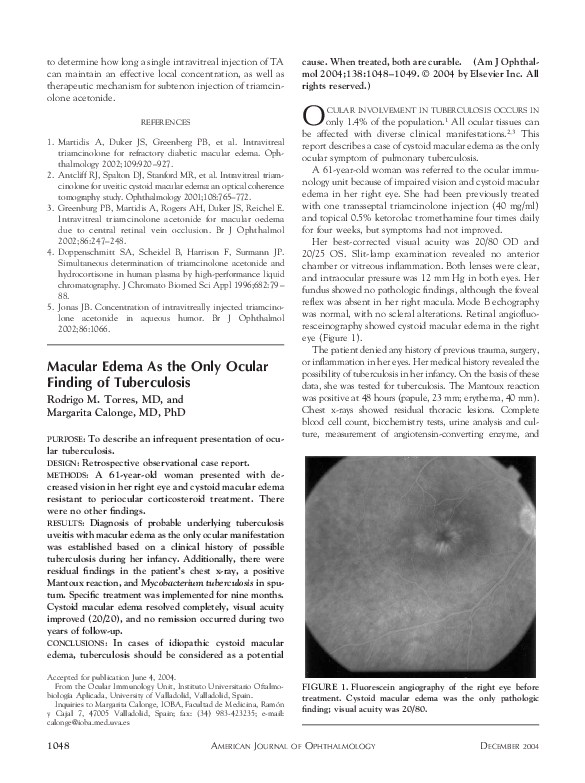 (PDF) Macular edema as the only ocular finding of tuberculosis